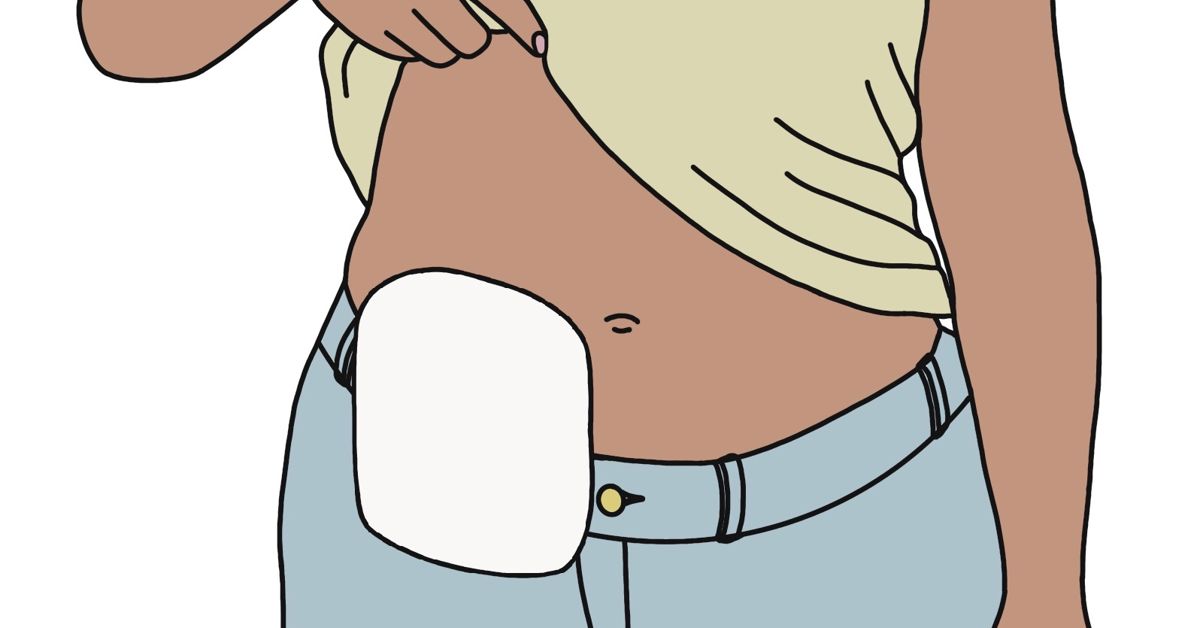 Stomi - Haraldsplass diakonale sykehus